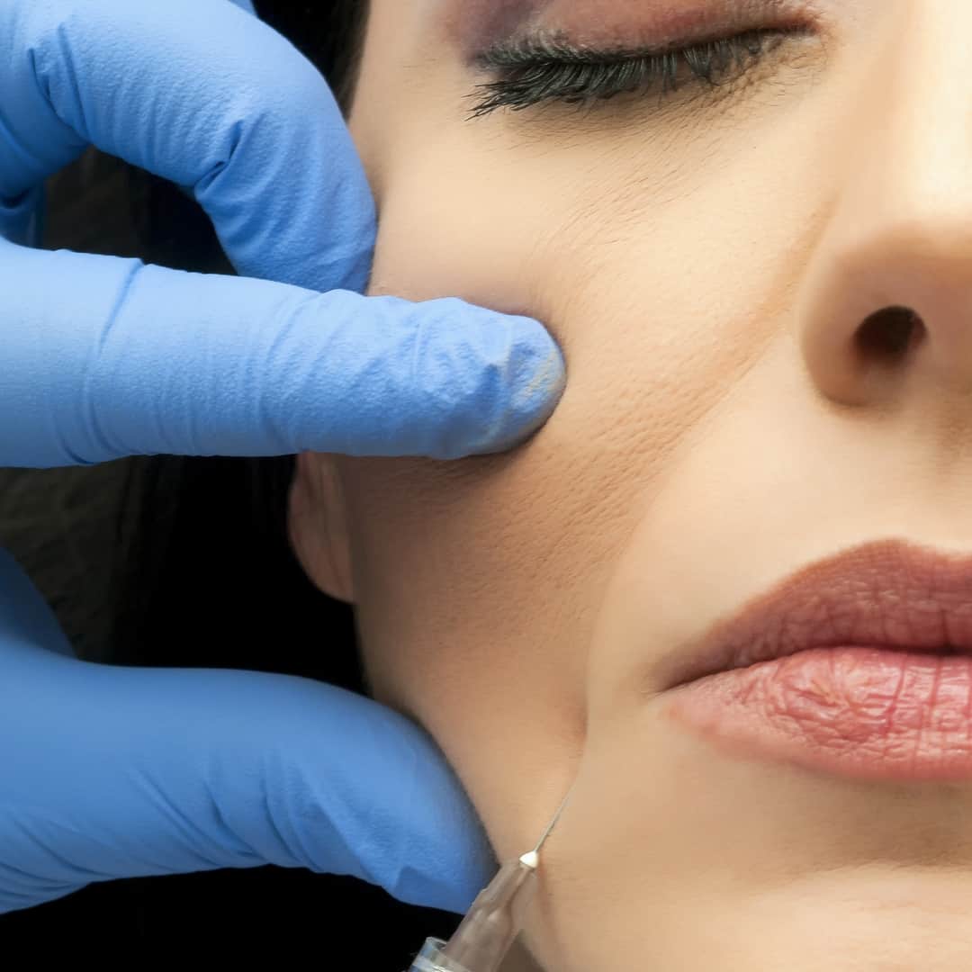 docteur-catherine-lesant-medecine-esthetique-sillon-nasogenien ...